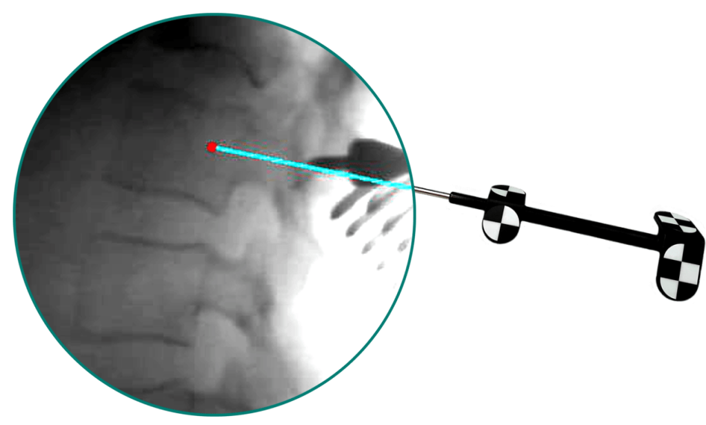 spine navigation - Medbionix